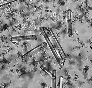 Removing Struvite from Wastewater Systems | Modern Pumping Today